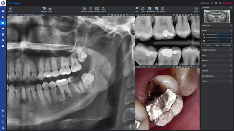 Romexis® 2D imaging software - MTC 祐鼎國際股份有限公司